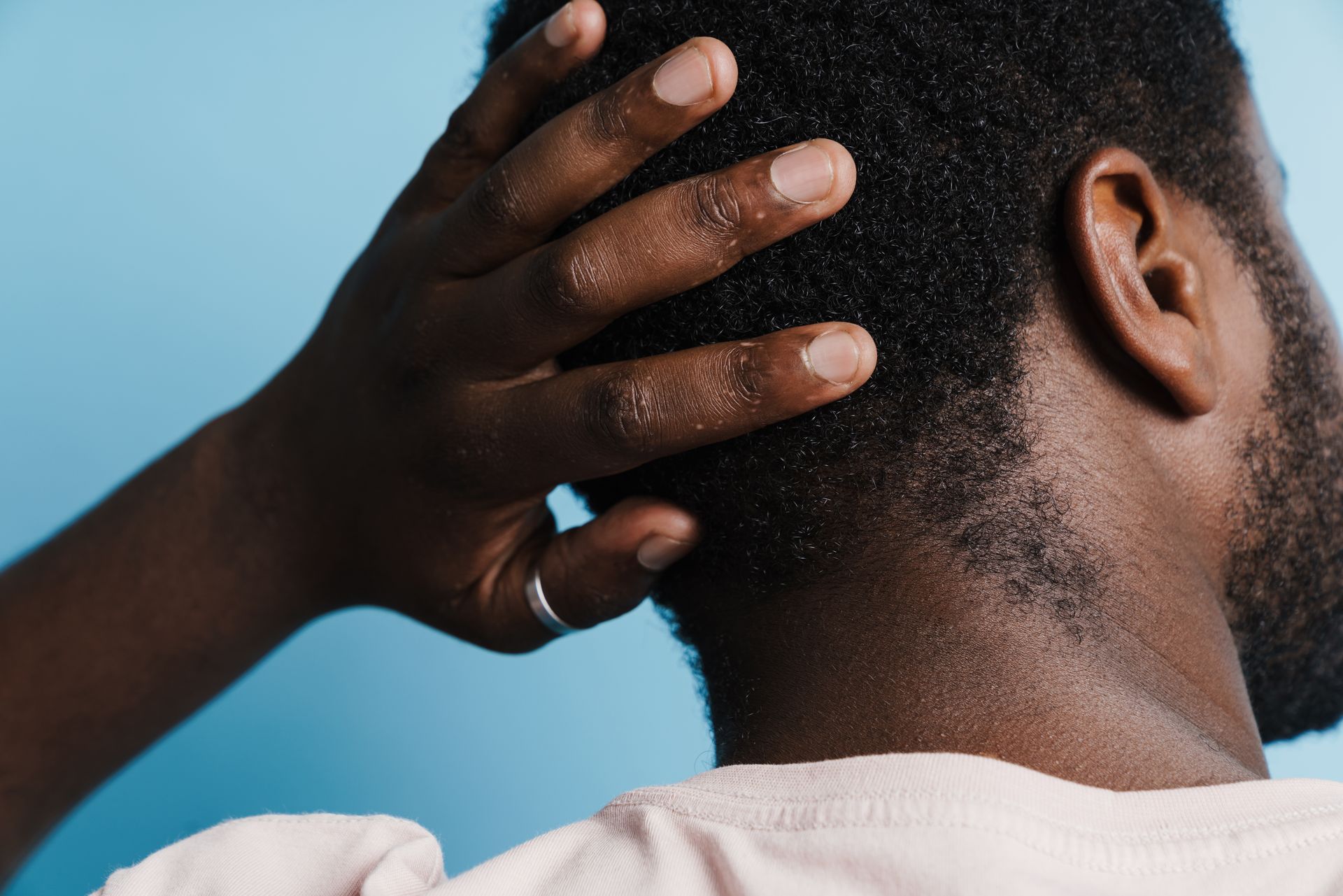Trichologist NYC & NJ | Hair Loss Specialist | Simone Trichology